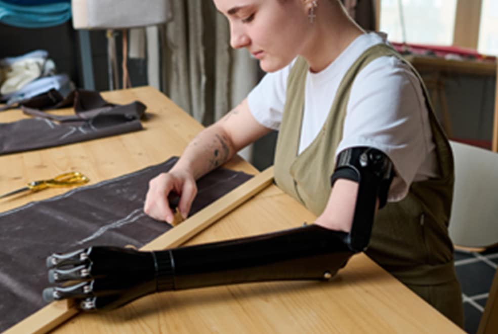 Third-Party Claims: Workplace Amputations – SMITH LAW, LLC